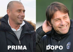 Ecco tutti gli sportivi con il parrucchino! [FOTO]